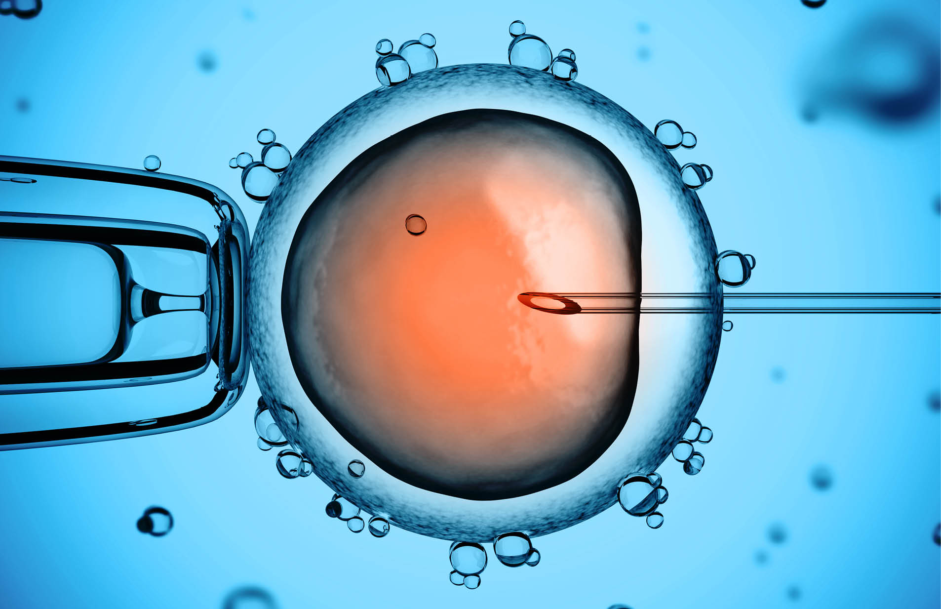 Inseminação artificial: como funciona? | Mulher e Gestação